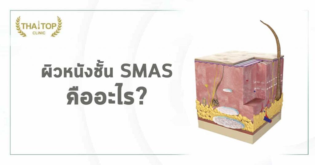 SMAS คืออะไร มีความสำคัญต่อการยกกระชับใบหน้าอย่างไร? เรามีคำตอบ