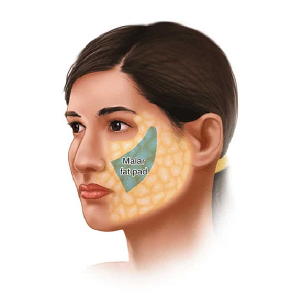 SMAS คืออะไร มีความสำคัญต่อการยกกระชับใบหน้าอย่างไร? เรามีคำตอบ